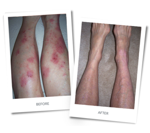 Connect Now With An Online Dermatologist | AZOVA